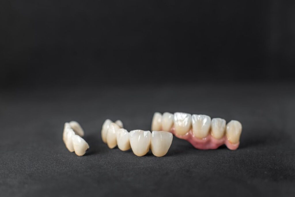 Loose Dental Crown: Common Signs and Re-cementing Options