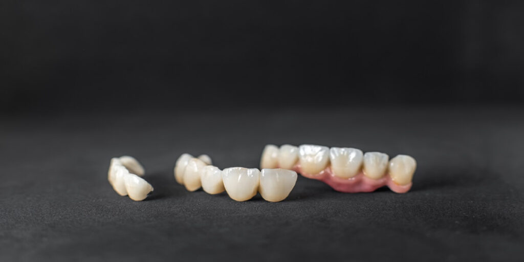 Why Does My Dental Crown Hurt When I Put Pressure On It?