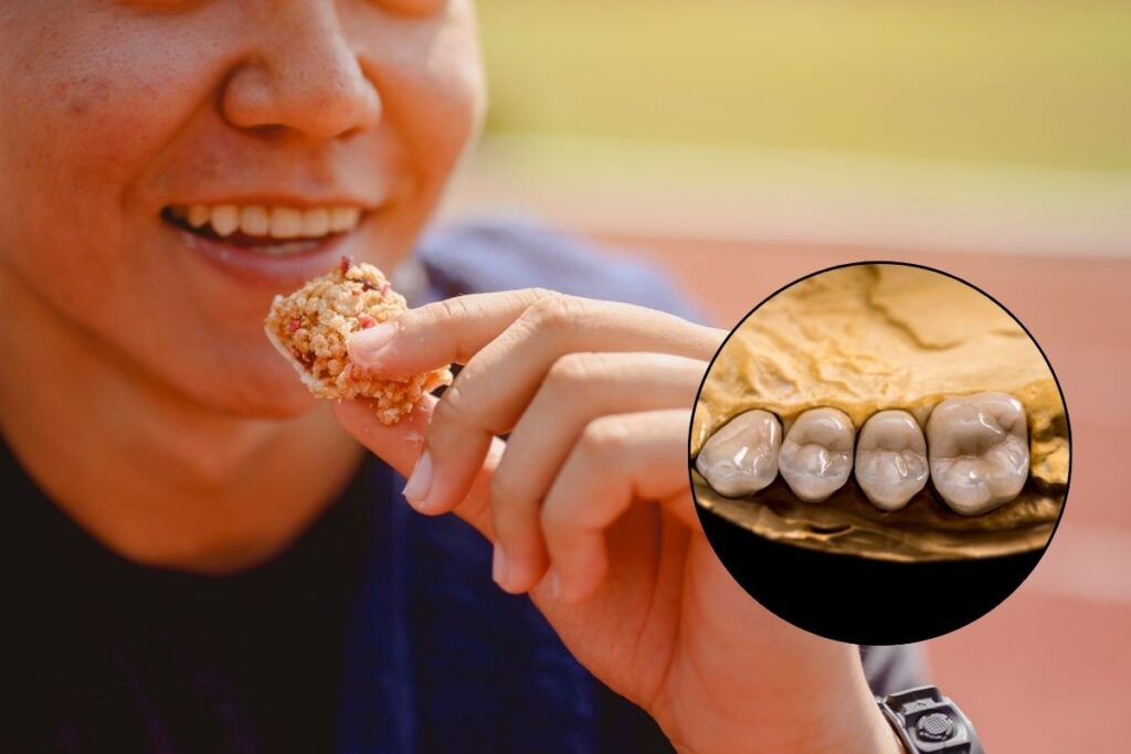 Loose Dental Crown: Common Signs and Re-cementing Options